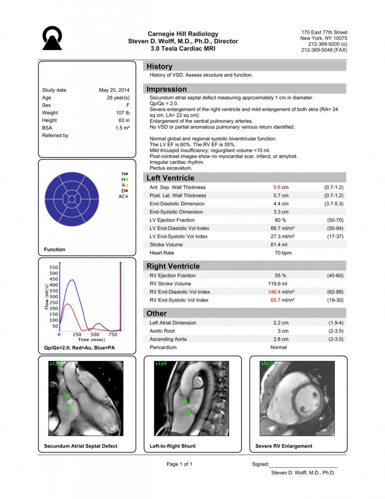 Atrial Septal Defect - Cardiac MRI