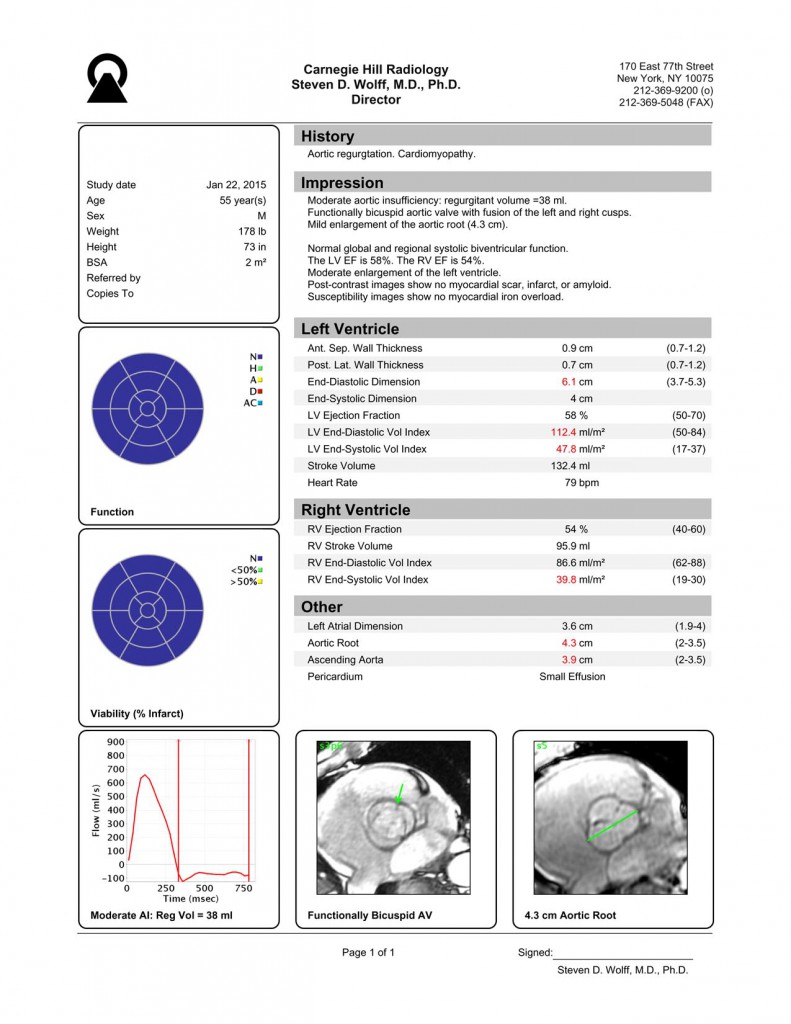 Aortic Regurgitation - Cardiac MRI